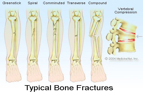Trauma And Fracture Surgery